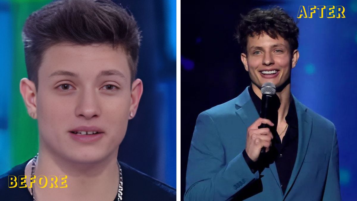 Comedian Matt Rife was insecure with his teeth so he get it done!